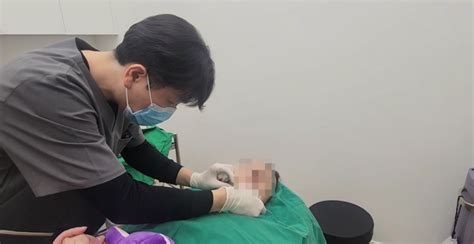 민트실리프팅 유지기간 효과 부작용 모두 말씀드립니다 네이버 블로그