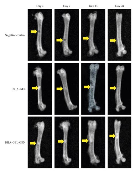 Radiograph Of Rat Femur The Yellow Arrow Indicates The Location Of The