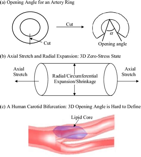 Schematic Drawing Of 3 Elements Concerning Zero Stress State In 3d Download Scientific Diagram