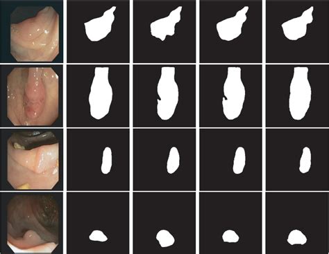 Figure 1 From Unet And Variants For Medical Image Segmentation