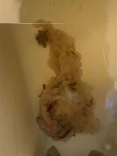 Mucus Full Stool Anyone Know Much About This Ribd