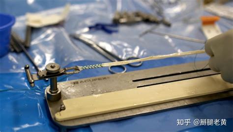 前交叉韧带重建患者必读！单束重建和双束重建哪个结实？有什么区别？ 知乎