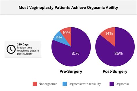 Most Patients Orgasmic After Gender Affirming Vaginoplasty Nyu