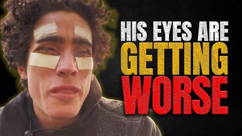 Cosmetic Surgery Fails The Conspiracy Behind Frank Tufanos Botched