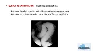 Doble Contraste En Radiologia Graphicres