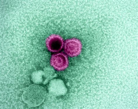 Nih Scientists Find Weak Points On Epstein Barr Virus National Institutes Of Health Nih
