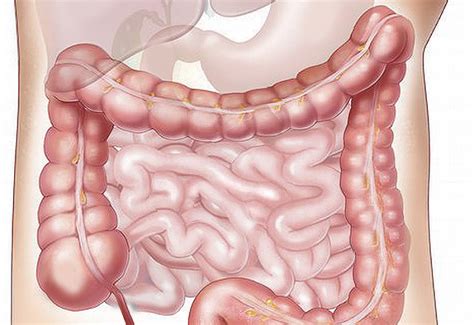 장내 세균 진화 통해 다른 장기 잠복