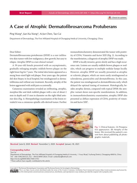 Pdf A Case Of Atrophic Dermatofibrosarcoma Protuberans