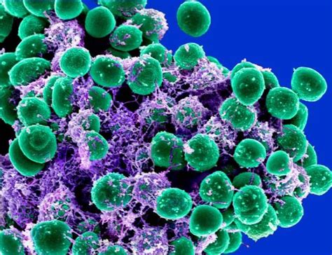 Staph Genes That Turn Commensal To Killer Identified