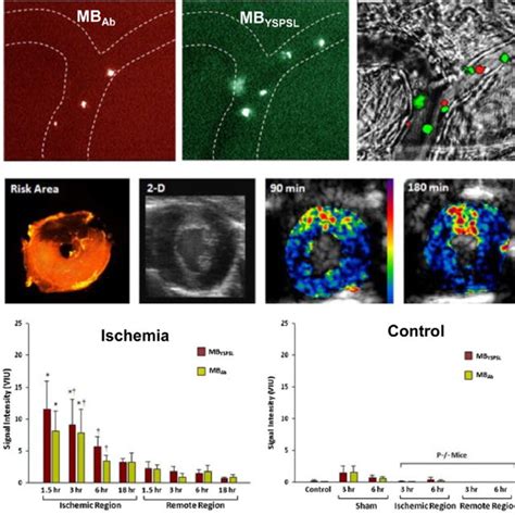 Molecular Imaging Of Recent Ischemia With P Selectin Targeted Download Scientific Diagram