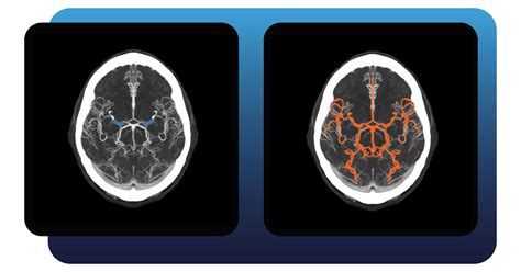 Aidoc Introduces The First And Only Ai Powered Solution To Identify