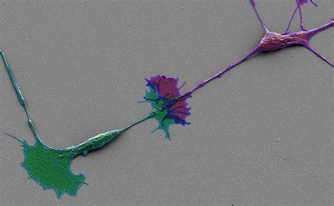 Biomaterials For Neural Regeneration Institute For Bioengineering Of Catalonia