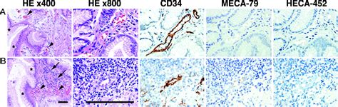 Induction Of Peripheral Lymph Node Addressin In Human Gastric Mucosa