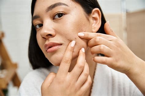 The Science Behind Differin Gel How It Works To Clear Acne