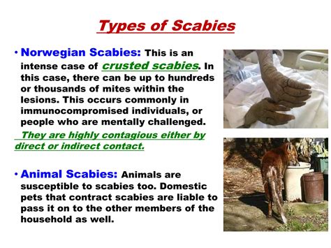 Scabies Pptx