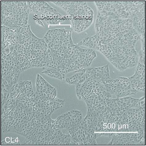 Example Of Optimal Cell Density For Capturing Microvillus Growth Events