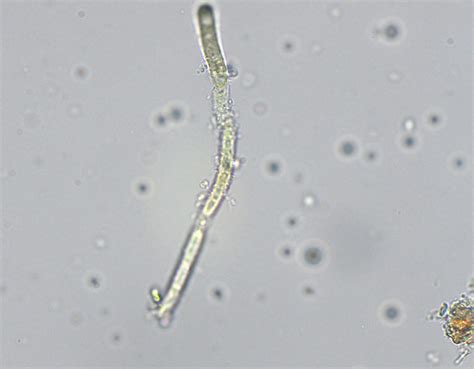 Urine Artifacts Eclinpath