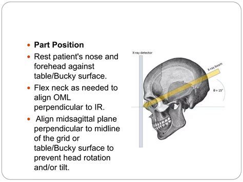 Skull Anatomy And Positioning Pptx