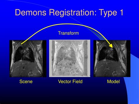 Ppt Itk Deformable Registration Powerpoint Presentation Free
