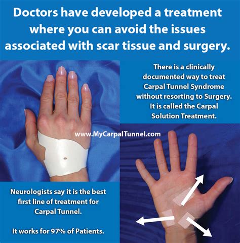 Carpal Tunnel Syndrome Surgery Scar