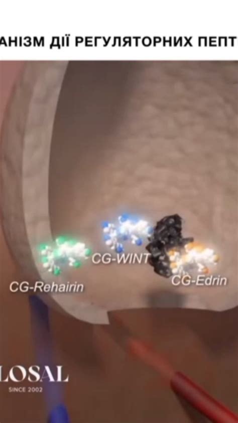 КОСМЕТОЛОГ Марія Бугайова УЖГОРОД Smas ліфтинг дає підтяжку за