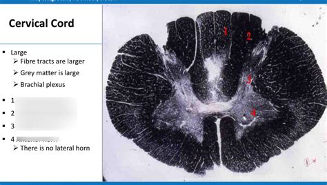 Diagram Of Cervical Cord Wiegart Quizlet