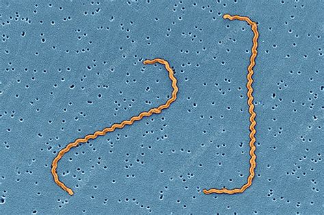 Leptospira Interrogans Stock Image B2201449 Science Photo Library