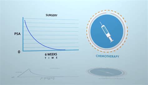 Surgery Vs Radiation For Treating Prostate Cancer