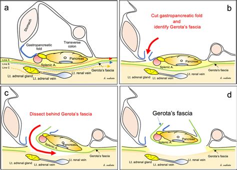 Schema Of Anatomical Relationships Around Pancreas A The Posterior