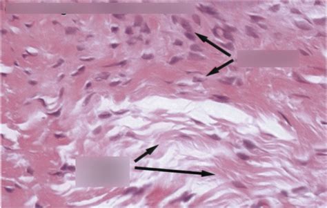 Dense Irregular Ct Cartilage Week 2 Lecture 1 Diagram Quizlet