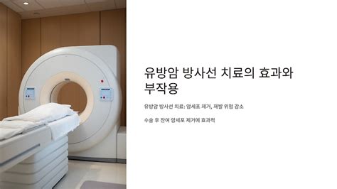 유방암 방사선 치료의 효과와 부작용