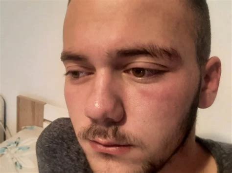 Napadnut Srpski Mladić Na Kim Mondo