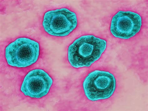 New Approach To Epstein Barr Virus And Resulting Diseases Bioquick News