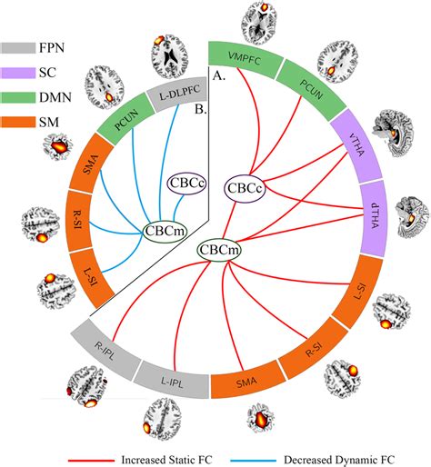 The Altered Static And Dynamic Functional Connectivity In Download Scientific Diagram