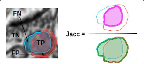Jaccard Similarity Coefficient Left In Blue The Ground Truth Download Scientific Diagram