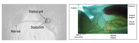 Identification Of The Statolith In A Whelk Body Statolith Structure