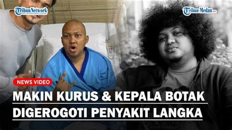 Permintaan Terakhir Babe Cabita Sebelum Meninggal Tak Mau Ada Tahlilan Di Rumahnya Gak Mau