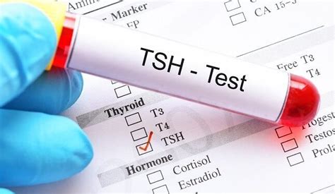 Thyroid Disorders Test Treat Refer