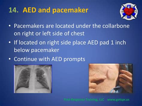 How To Use An Aed PPTX