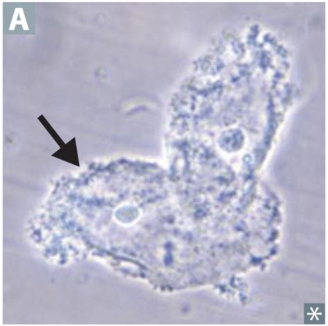 Micro Specimen Processing Direct Exam Quiz Flashcards Quizlet