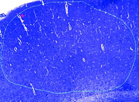 The Areas From Prefrontal Cortex And Hippocampus Were Selected Via 40x Download Scientific