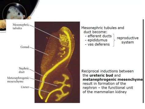 Paraxial And Intermediate Mesoderm Pptx
