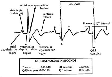 Pr Interval Normal Range CallumgroBerger