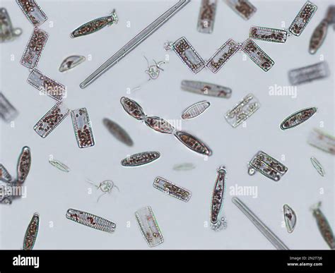Diatoms Algae Under Microscope