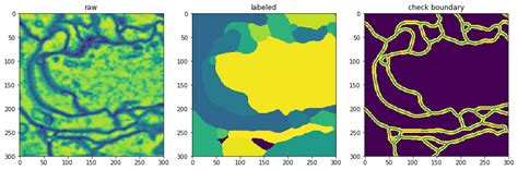 github celisun deep learning automated neuron segmentation electron