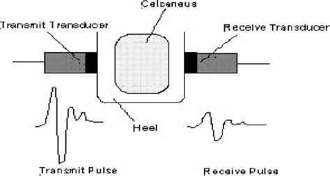 The Transmission Technique Illustrating The Low Frequency Fil Tering