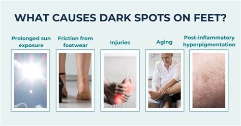 How To Get Rid Of Dark Spots On Feet A Complete Guide Purehealth