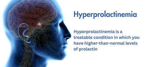 Hyperprolactinemia Symptoms And Management Strategies