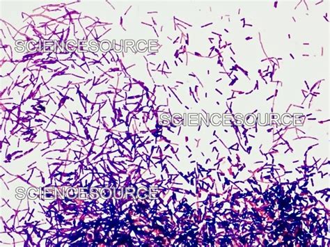 Gram Positive Bacteria Bacilli Under Stock Image Science Source