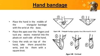 Bandaging Triangular Bandaging And Cravat Types Of Knots Pptx